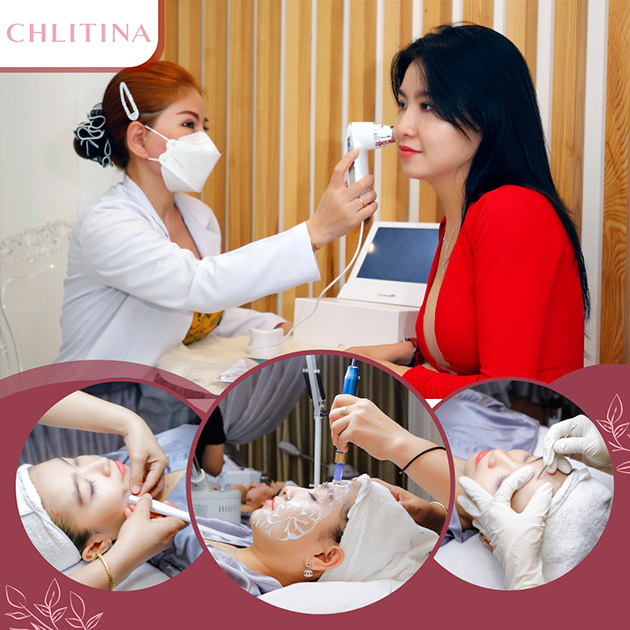 Chlitina Beauty Spa - Chạy Vitamin C/ Cấy Tảo/ Trị Mụn