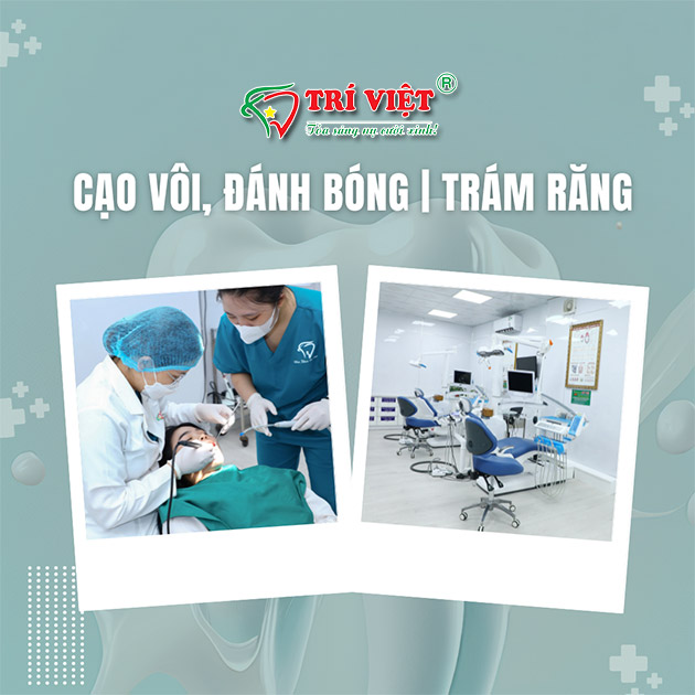 Nha Khoa Trí Việt - Cạo Vôi, Đánh Bóng/ Trám Răng